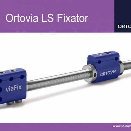 Spinamer | Ortovia Mini Fixators