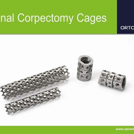 Spinamer | Expandable Spinal Cages